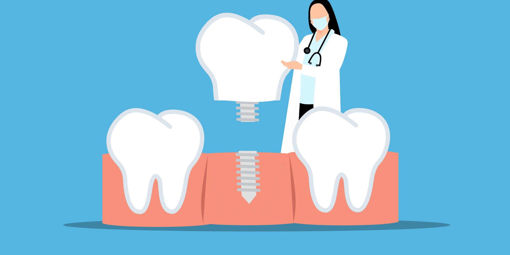Dental Implants: How to Know If and When You Need One - Adventure Crunch